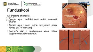 PAPER_Sistemic Arterial Hypertension Disease_Cahaya Mawaddah 2 (1).pptx
