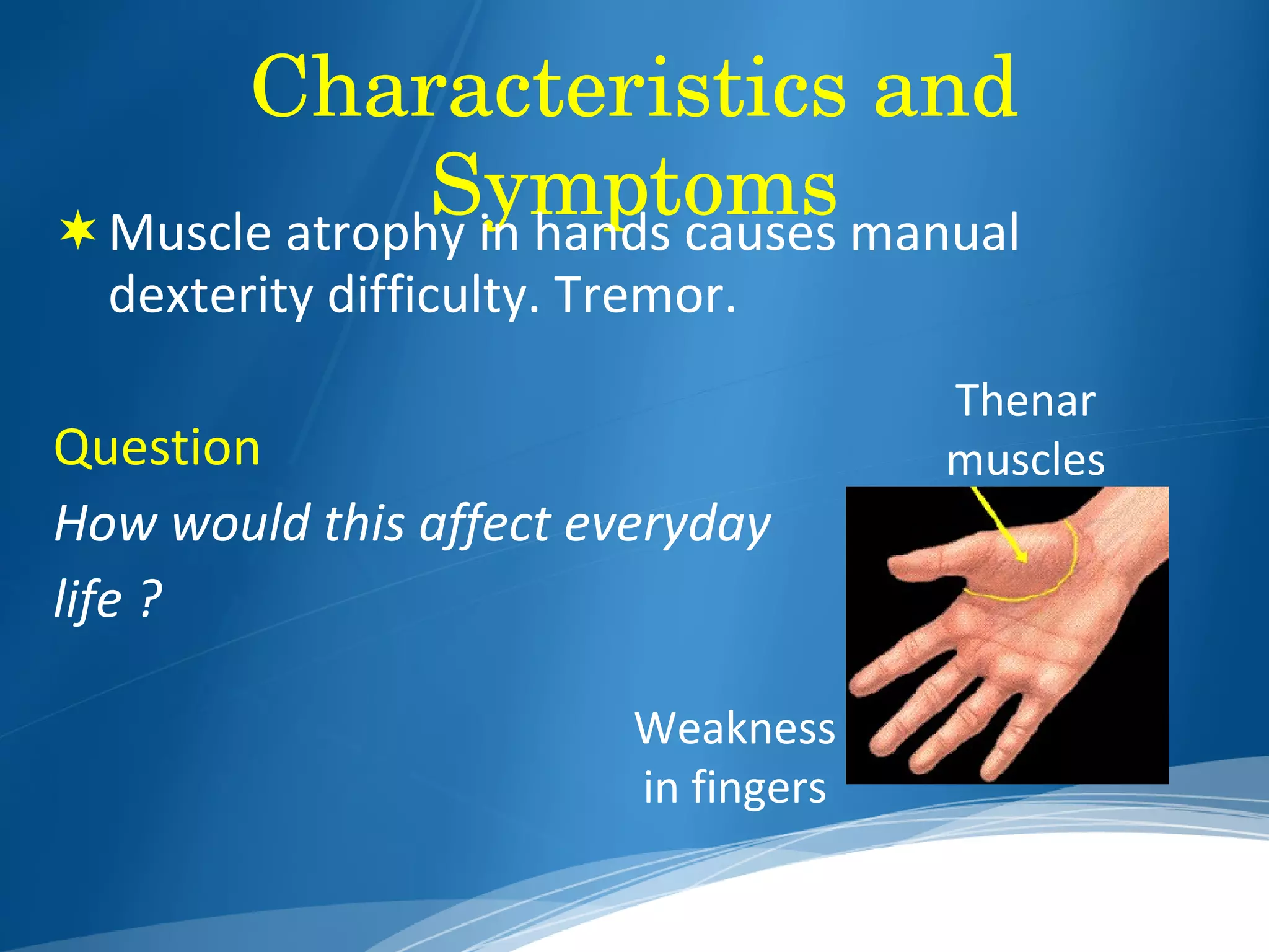 CMT slides: understand the disease. | PPT
