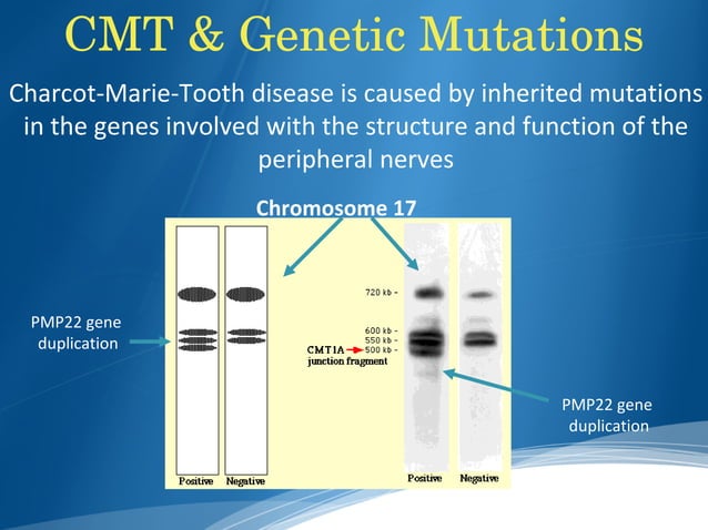 CMT slides: understand the disease. | PPT