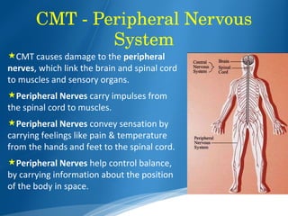 CMT slides: understand the disease. | PPT