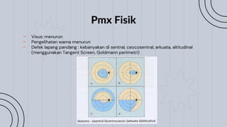Papilitis.pptx