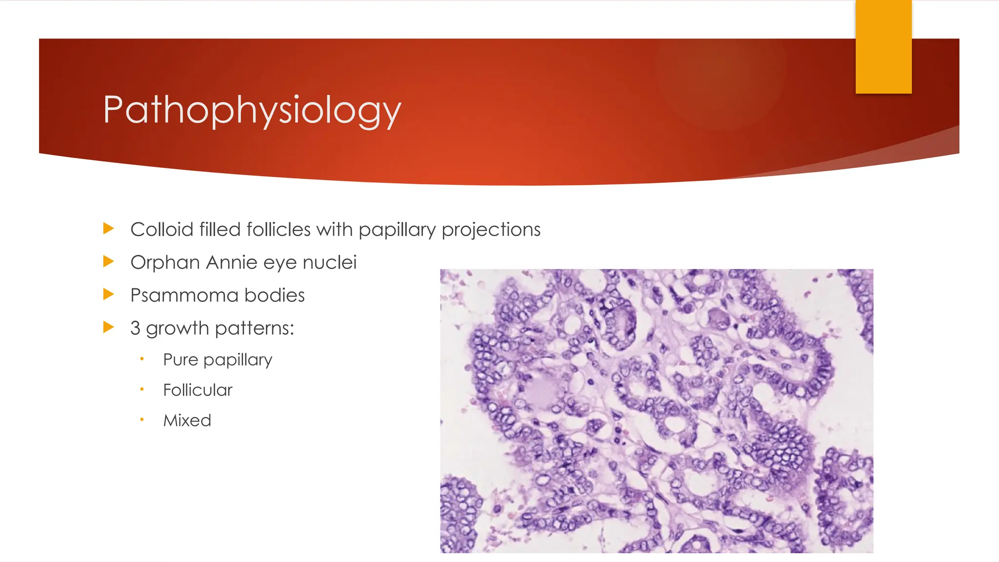 Papillary Carcinoma Thyroid and management.pptx