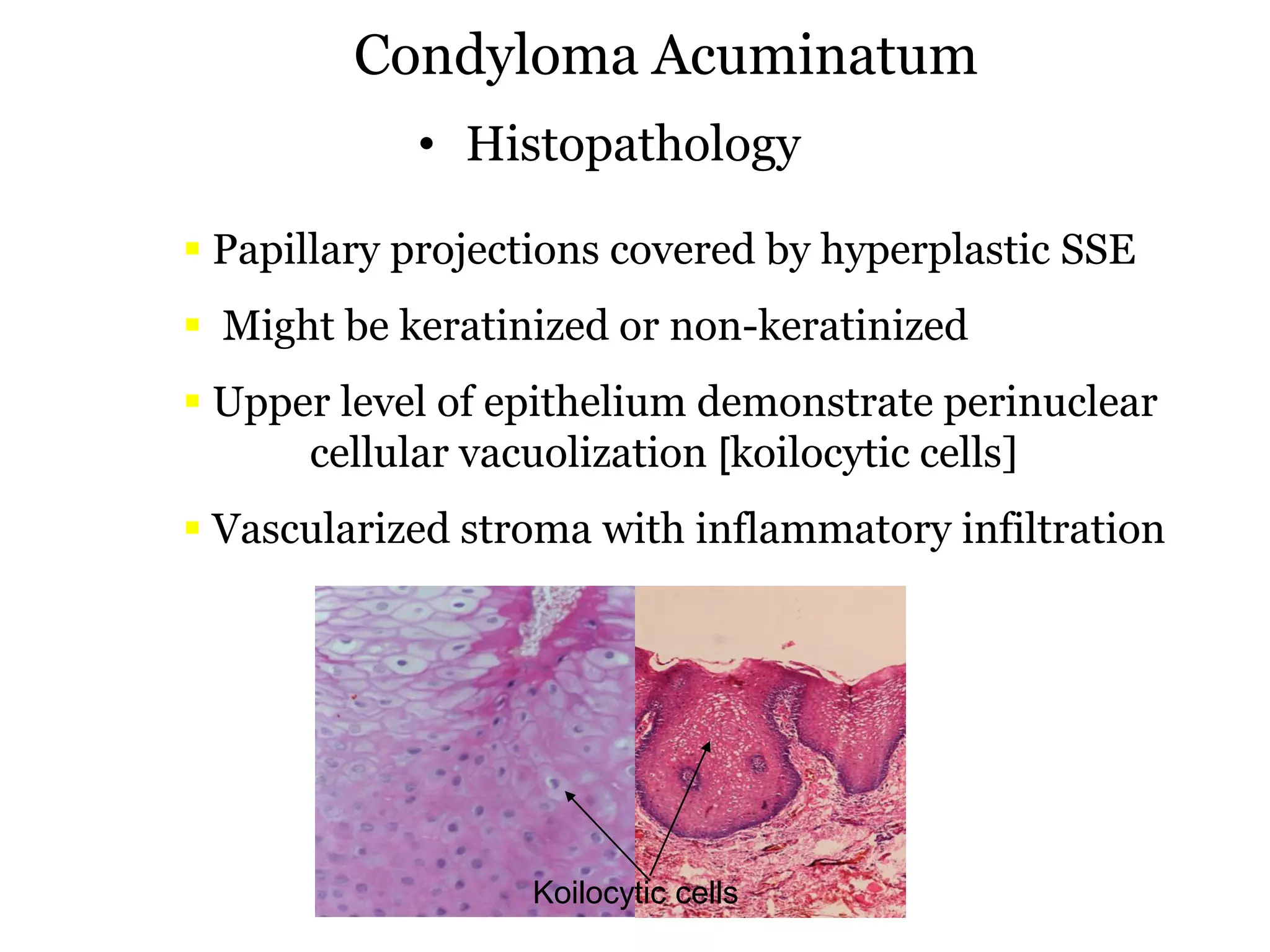 Papillary lesions | PDF