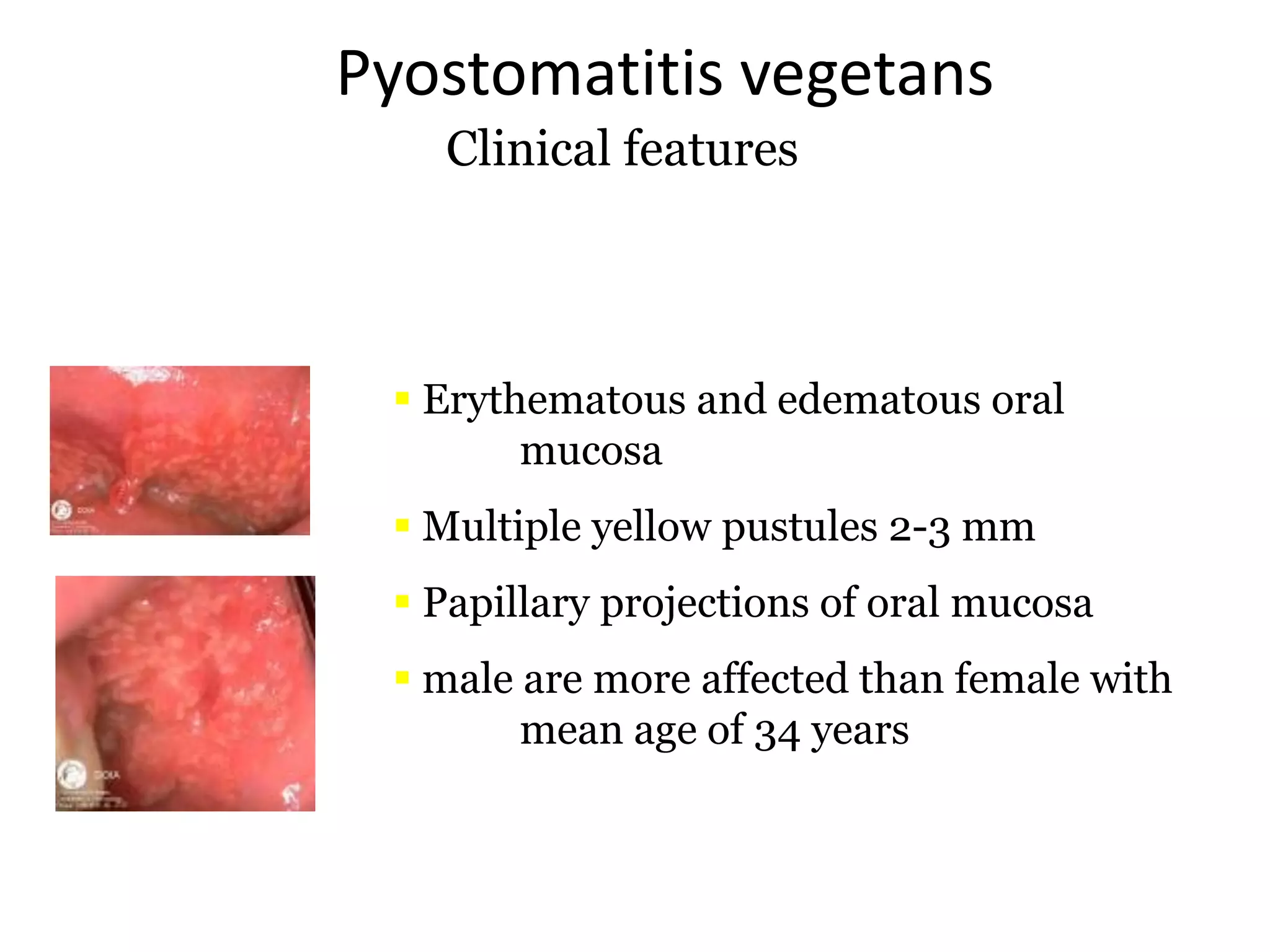 Papillary lesions | PDF