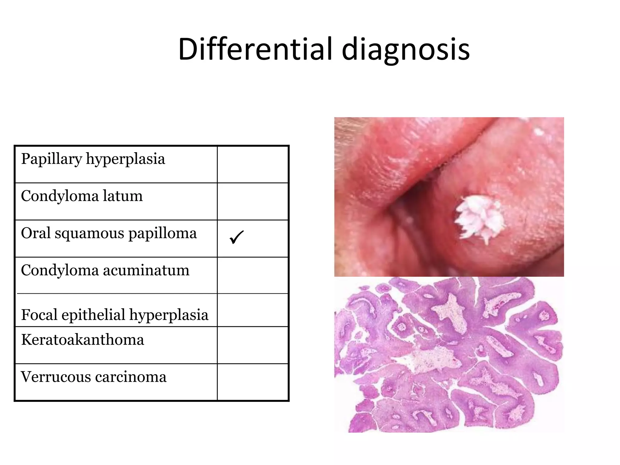 Papillary lesions | PDF