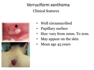 Verruciform Xanthoma