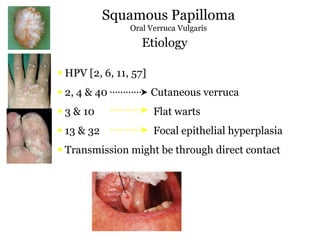 Verruca Vulgaris Oral