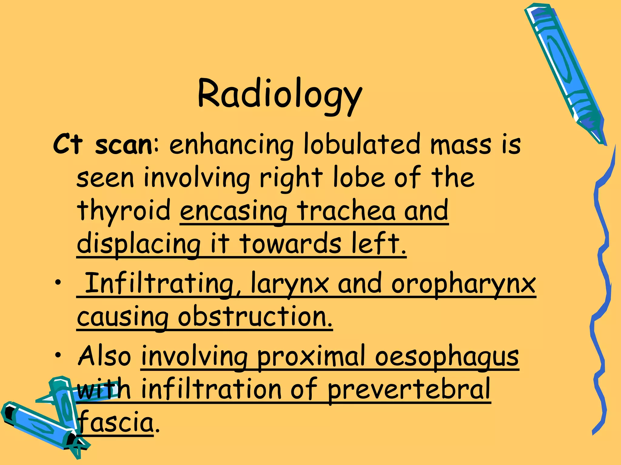 Papillary Thyroid Carcinoma Ppt