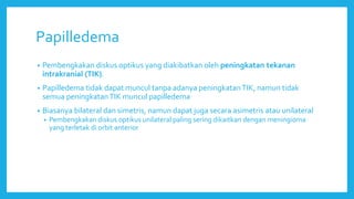 Papilledema.pptx