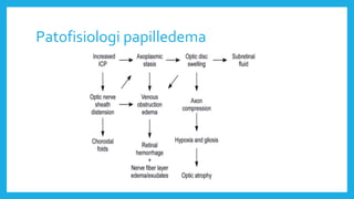 Papilledema.pptx