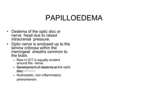 Papilledema | PPTX | Eye and Vision Conditions | Diseases and Conditions