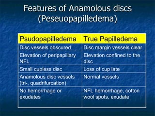 Papilledema Or No Papilledema | PPT