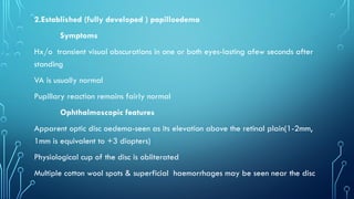 PAPILLOEDEMA IN OCULAR MANAGEMENT PPT NOTES | PPTX | Eye and Vision ...