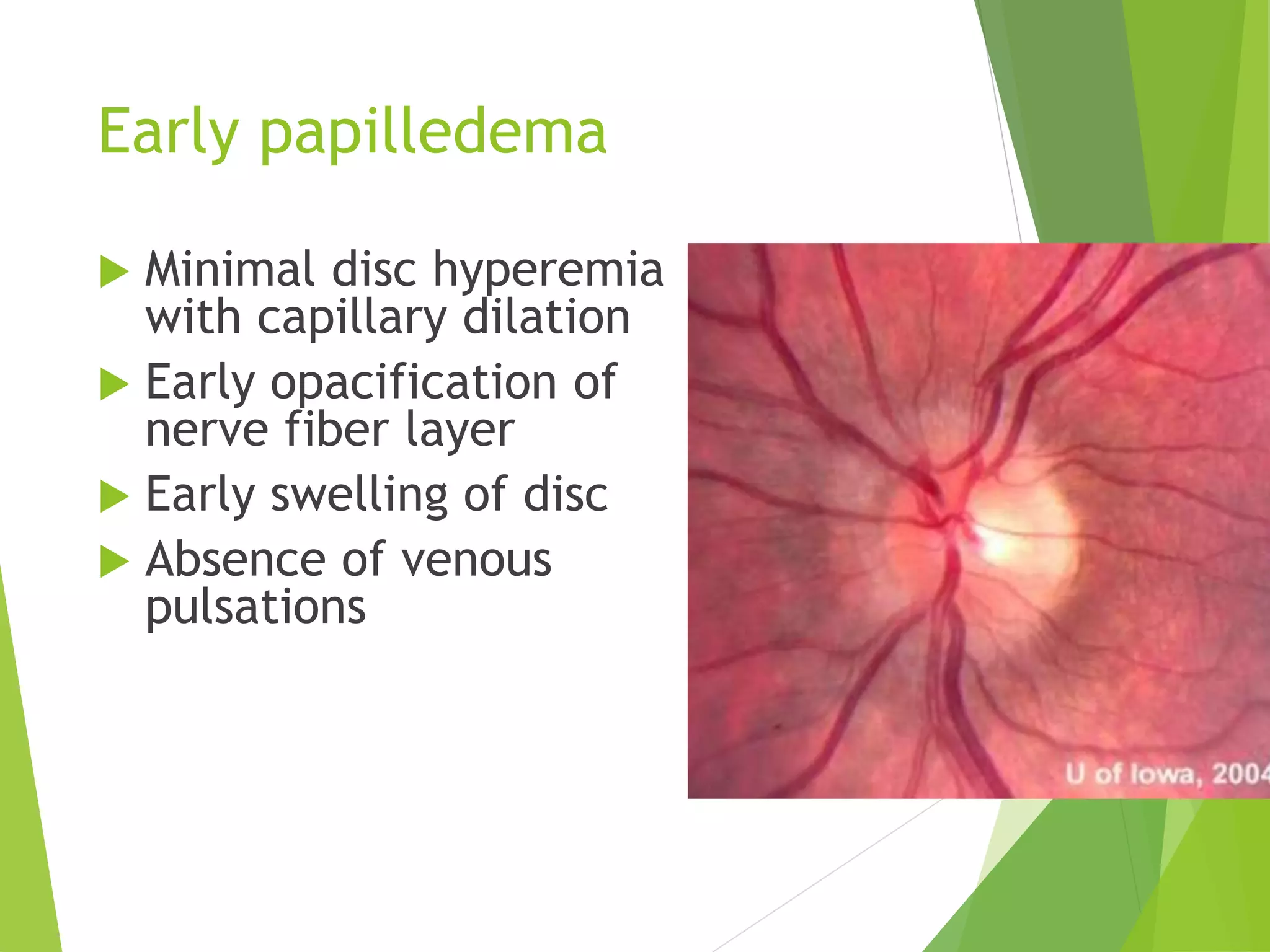 Papilloedema and Optic Atrophy.ppt