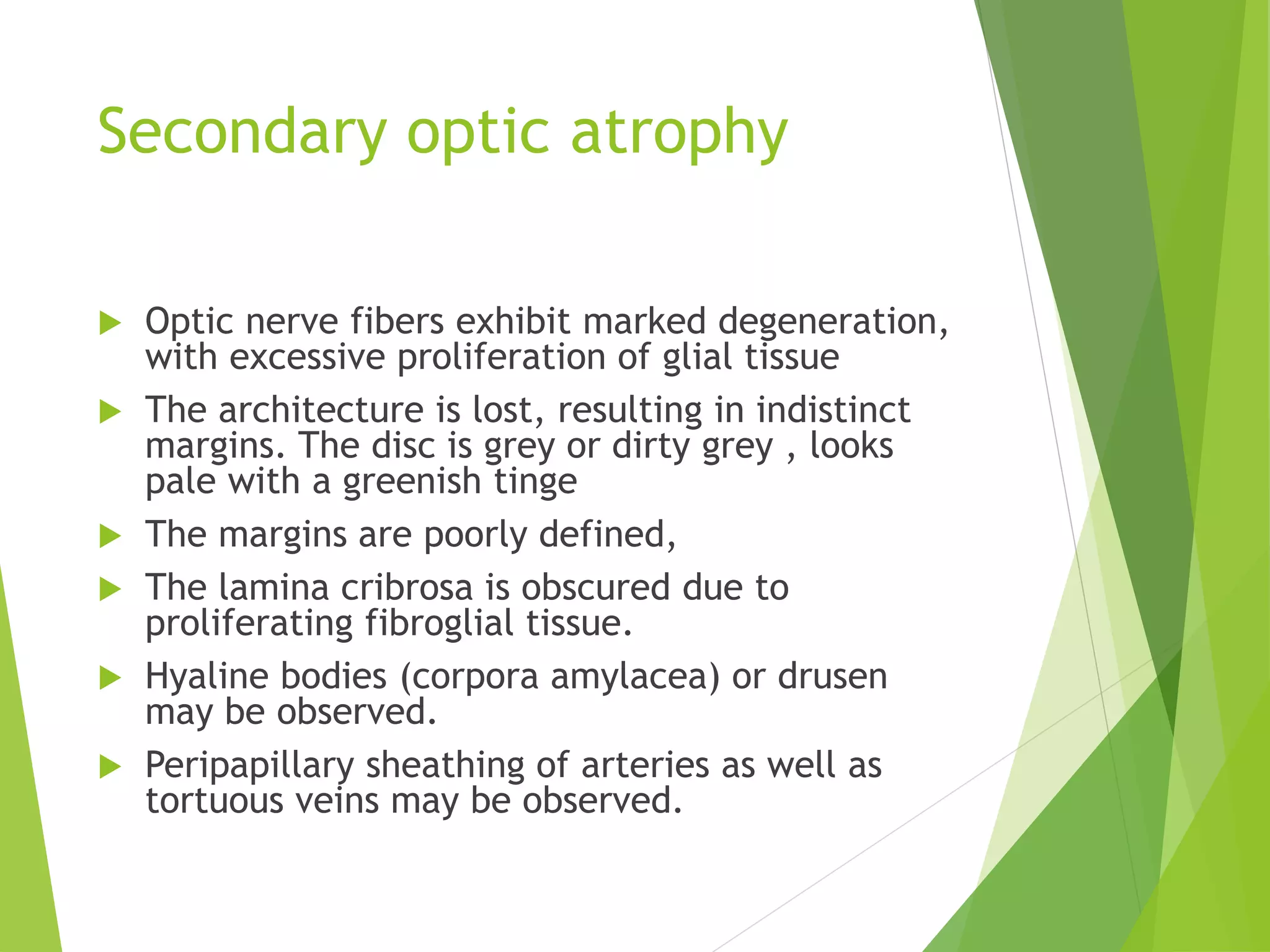 Papilloedema and Optic Atrophy.ppt