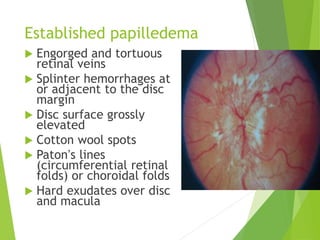 Papilloedema and Optic Atrophy.ppt