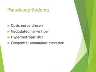 Papilloedema and Optic Atrophy.ppt