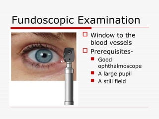 Papilloedema and Optic Atrophy-optha.ppt