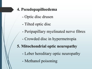 Papilloedema presentation1 | PPTX