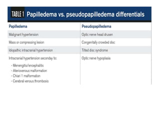 Papilloedema | PPTX | Eye and Vision Conditions | Diseases and Conditions