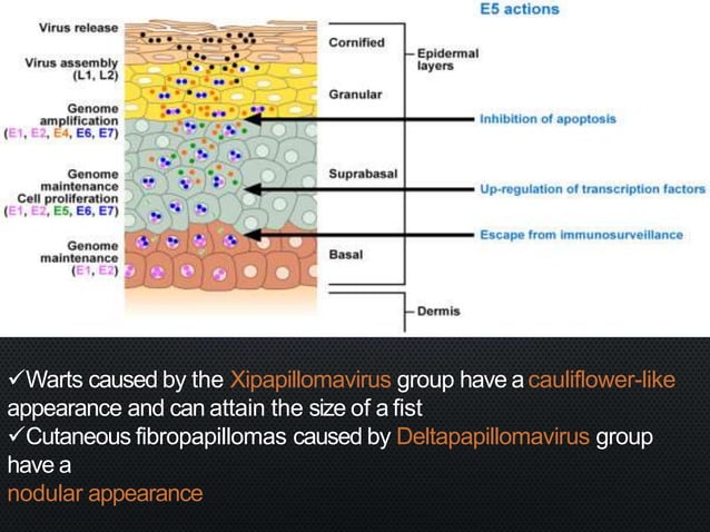 Papillomatosis | PPTX