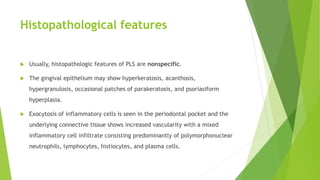 Papillon-Lefevre Syn. | PPTX