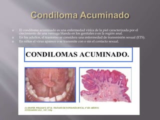 Papiloma | PPTX