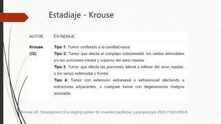Papiloma nasal invertido | PPTX