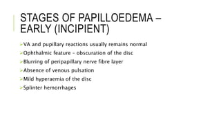 PAPILLOEDEMA | PPTX