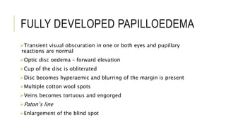PAPILLOEDEMA | PPTX