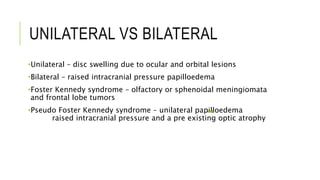 Unilateral Papilledema