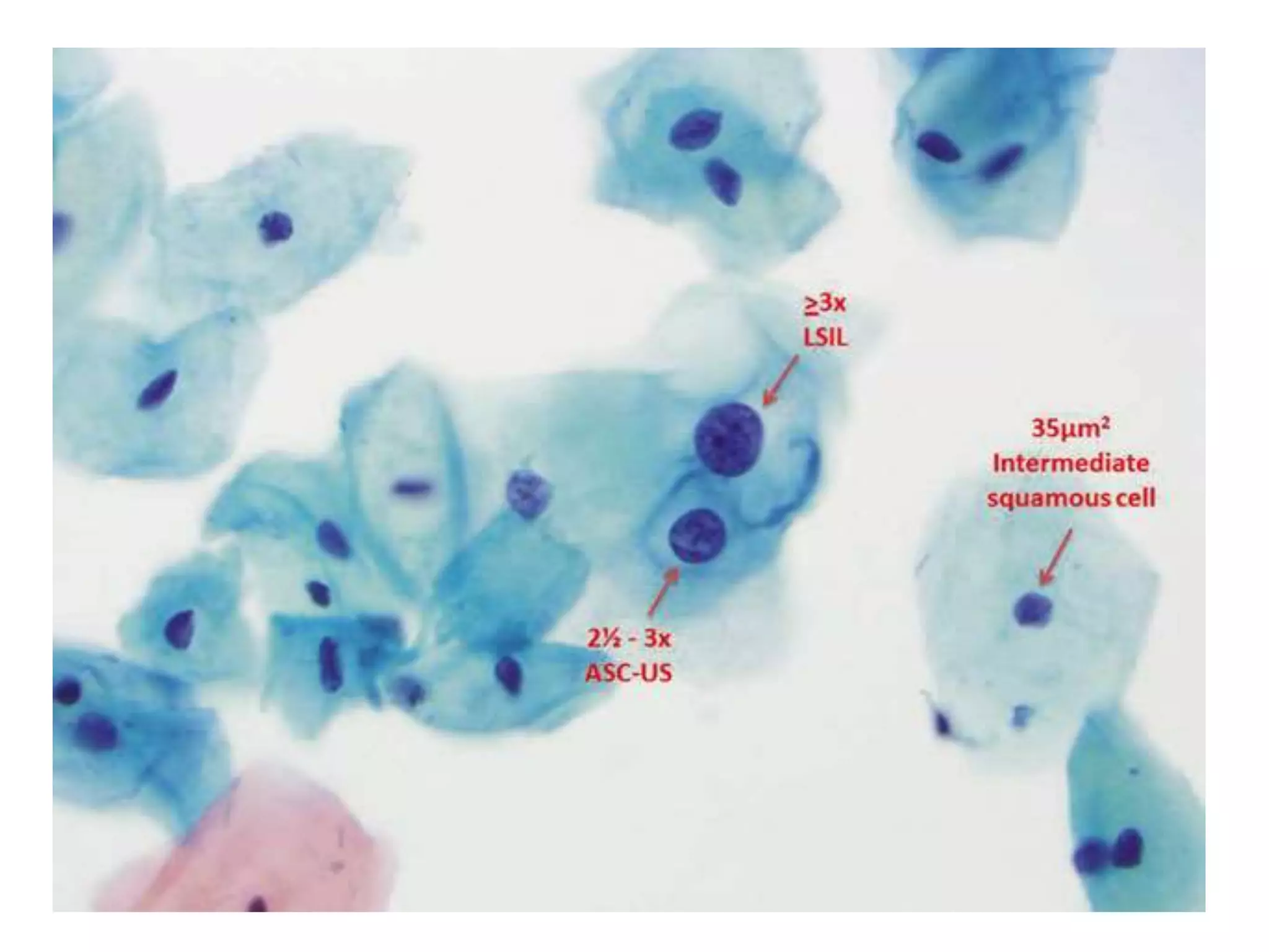 Pap smear Examination | PPTX