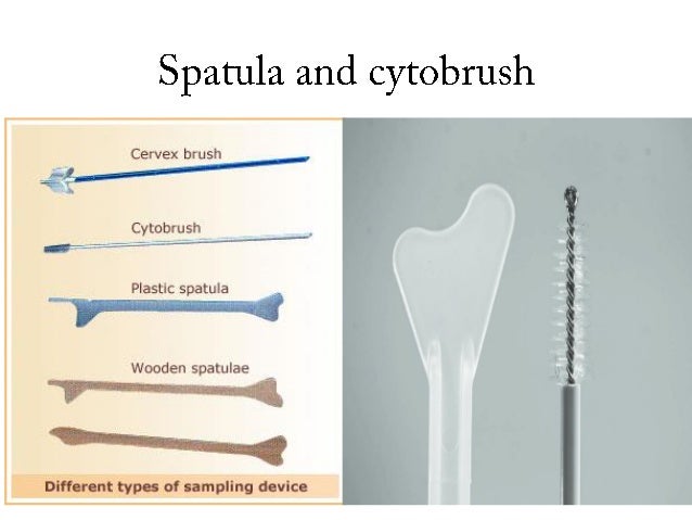 Pap smear and procedure