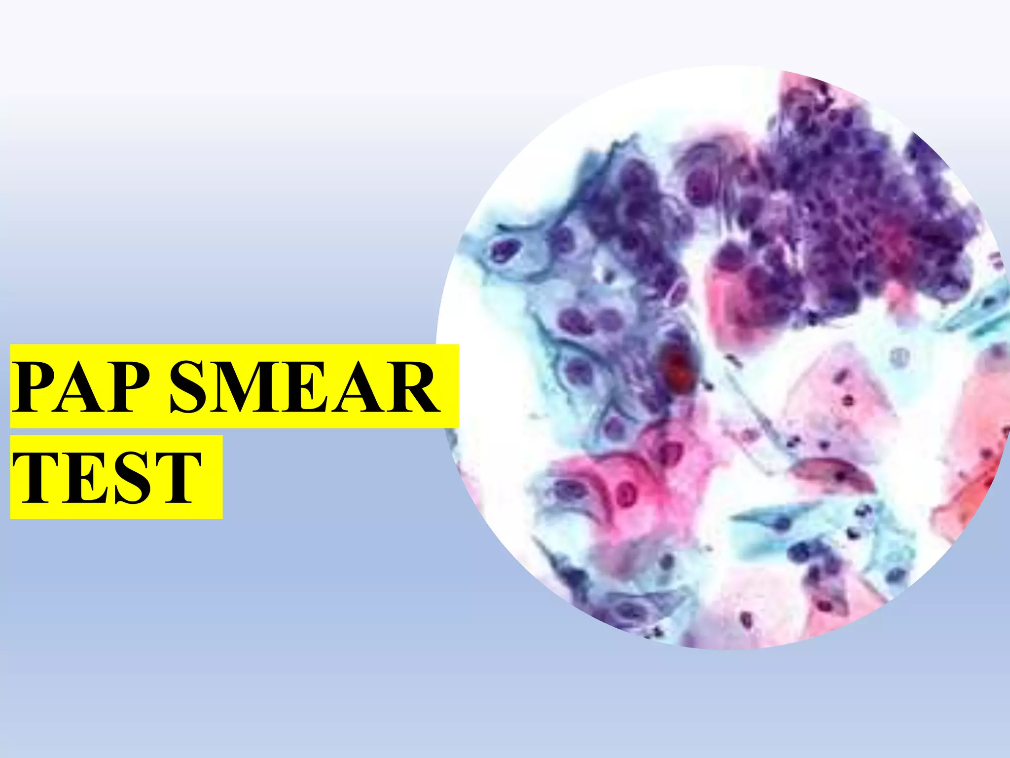PAP smear.pptx