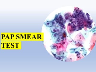 PAP smear.pptx