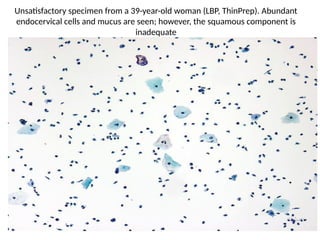 PAP SMEAR.pptx with gynae and pathology correlation | PPTX