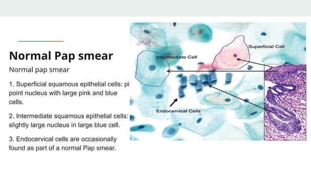 Pap Smear ppt for pathology staining + cytology | PPTX