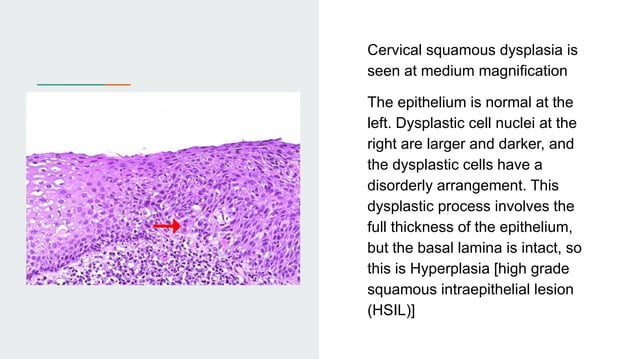 Pap Smear ppt for pathology staining + cytology | PPTX