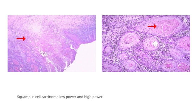 Pap Smear ppt for pathology staining + cytology | PPTX