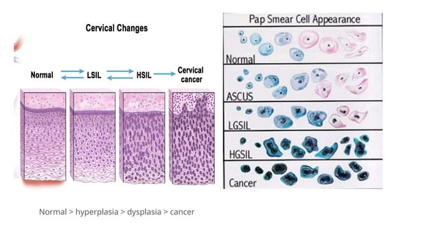 Pap Smear ppt for pathology staining + cytology | PPTX