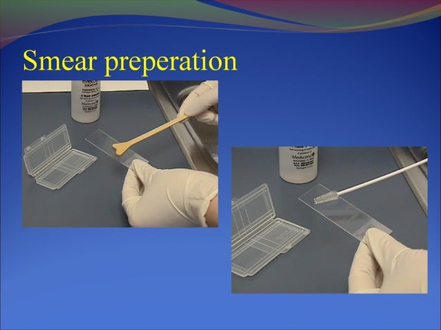 Pap smear (2) | PPT | Reproductive Health | Diseases and Conditions