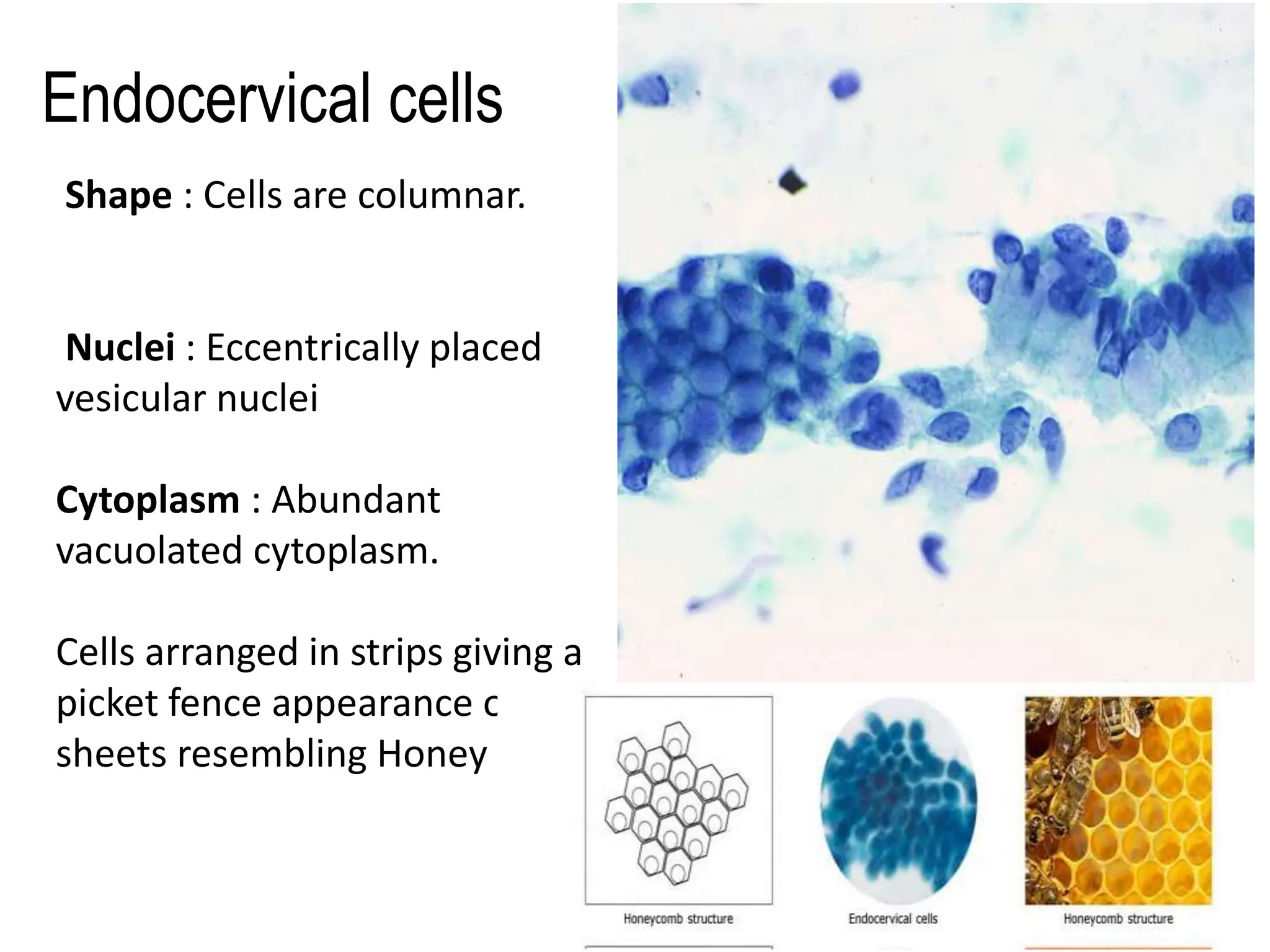PAP SMEAR examination in cytology 23.pptx
