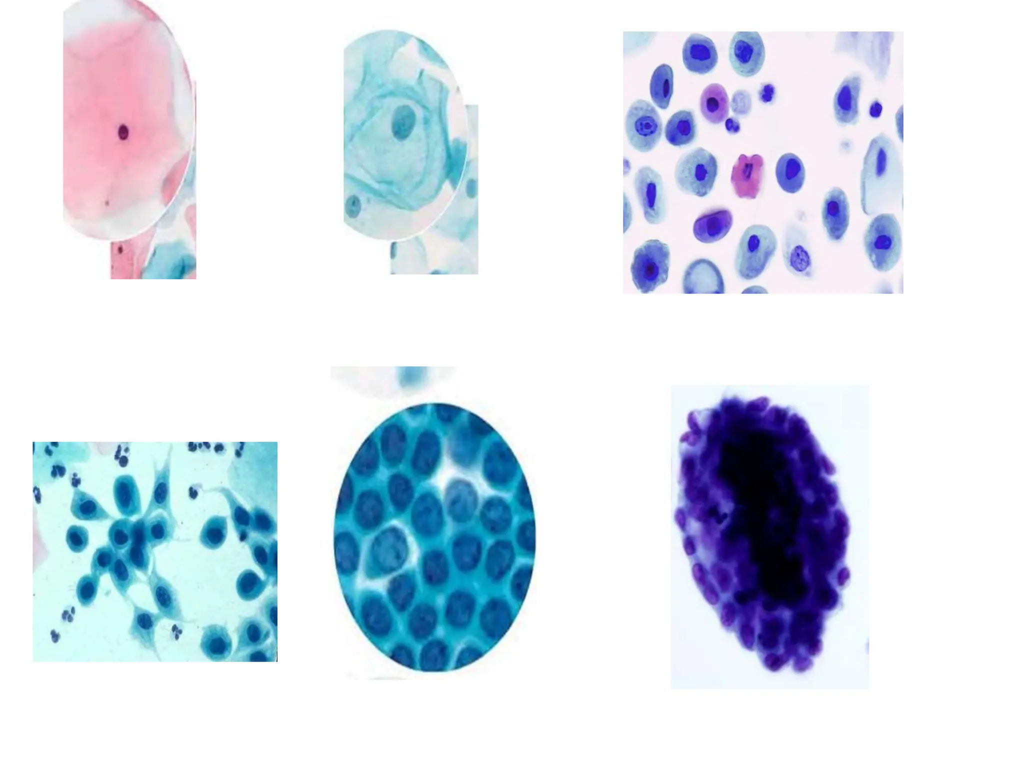 PAP SMEAR examination in cytology 23.pptx