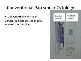 PAP SMEAR examination in cytology 23.pptx