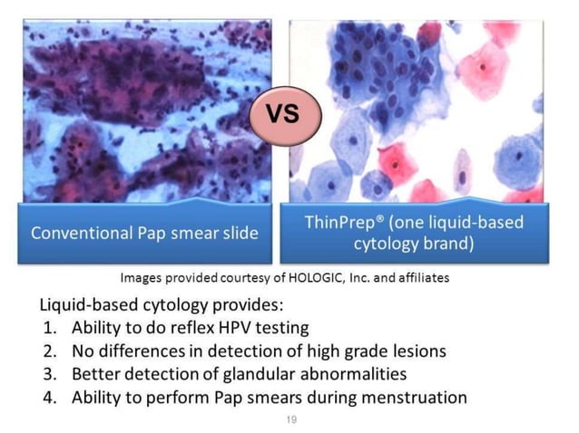 PAP SMEAR examination in cytology 23.pptx
