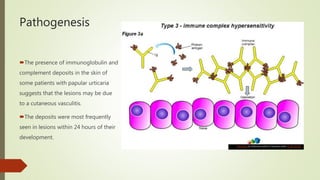 Papular urticaria | PPTX