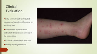 Papular urticaria | PPTX