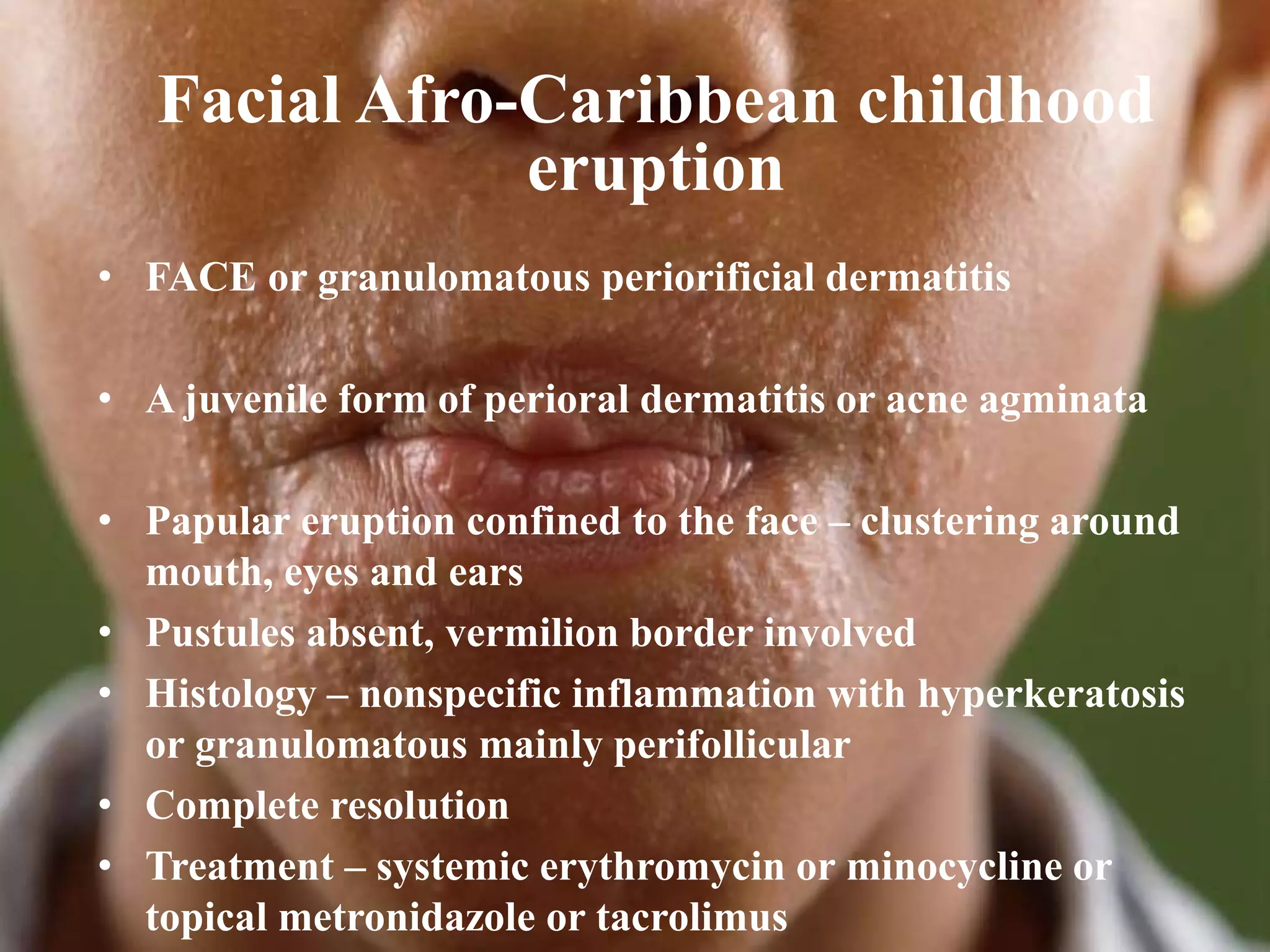 differentials of papules on face | PPTX