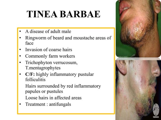 differentials of papules on face | PPTX | Skin and Dermatology ...