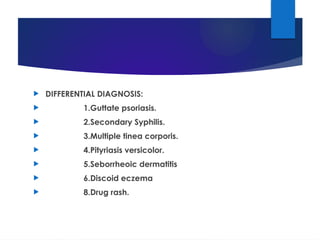 Papulosquamous Disorders including psoriasis, lichen planus, pityriasis ...